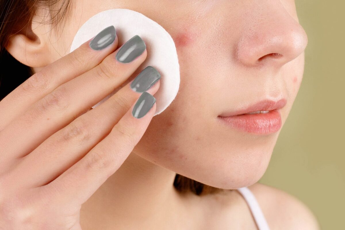 Aterom: Uzrok, simptomi i kako se ovaj, često bolan, problem najbolje ...